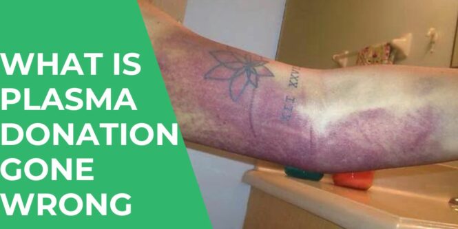 Plasma Donation Gone Wrong: Complications & Prevention Guide